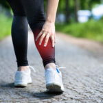 Claudication Treatment | The Vascular Care Group